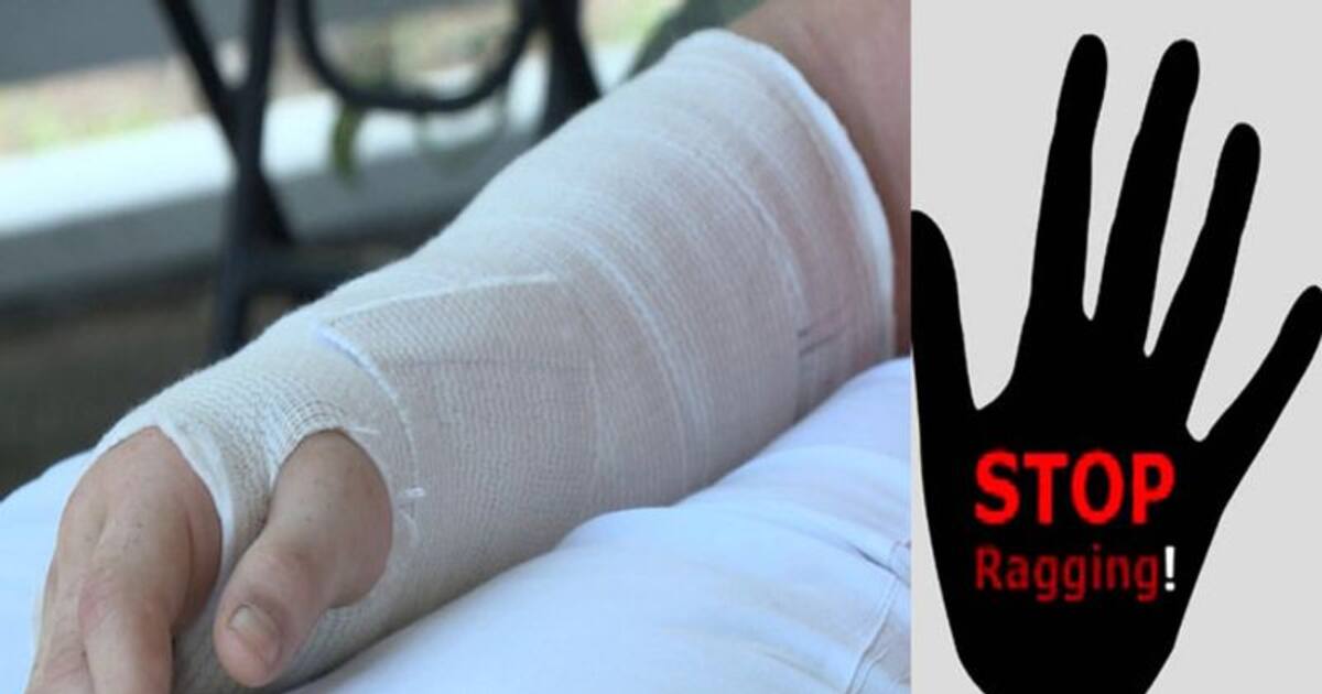 റാഗിങ് വിവരം പുറത്ത് പറഞ്ഞ പ്ലസ് വണ്‍ വിദ്യാര്‍ത്ഥിയുടെ കൈ സീനിയര് ...