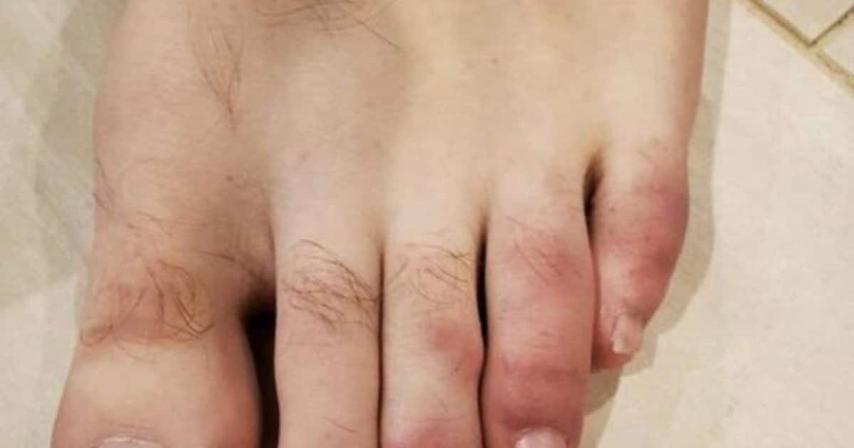 What does it mean when your second toe is longer than your big toe? rsl