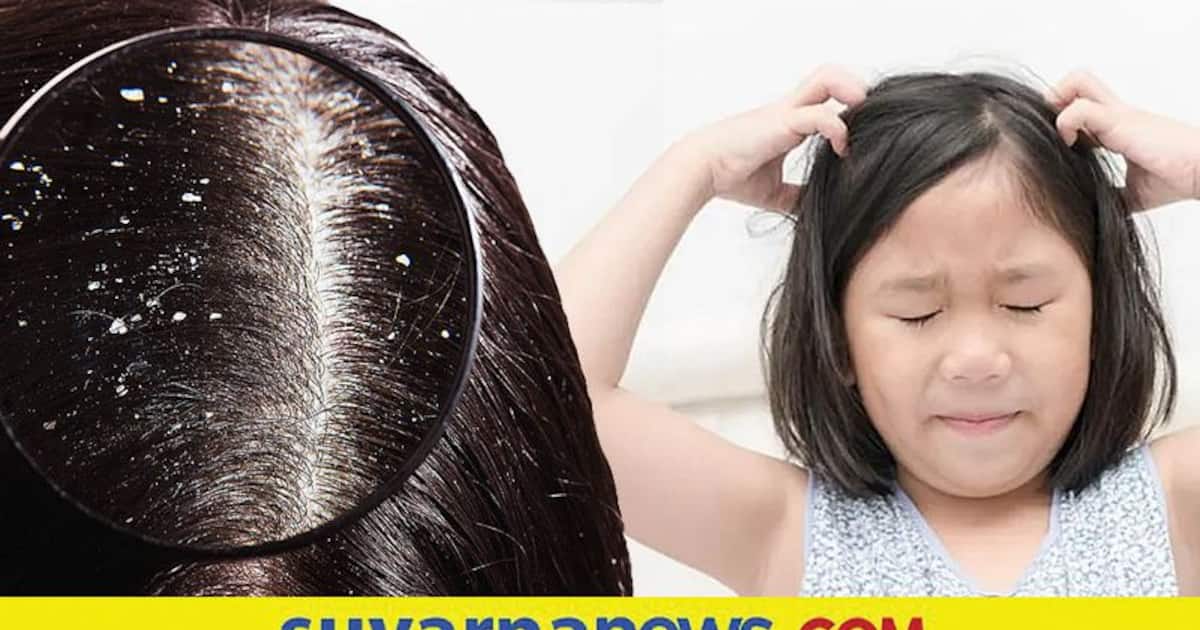 Dandruff : ಆಗಾಗ ತಲೆ ತುರಿಸಿಕೊಳ್ಳುವ ಮಕ್ಕಳ ಬಗ್ಗೆ ನಿರ್ಲಕ್ಷ್ಯ ಬೇಡ | Children ...