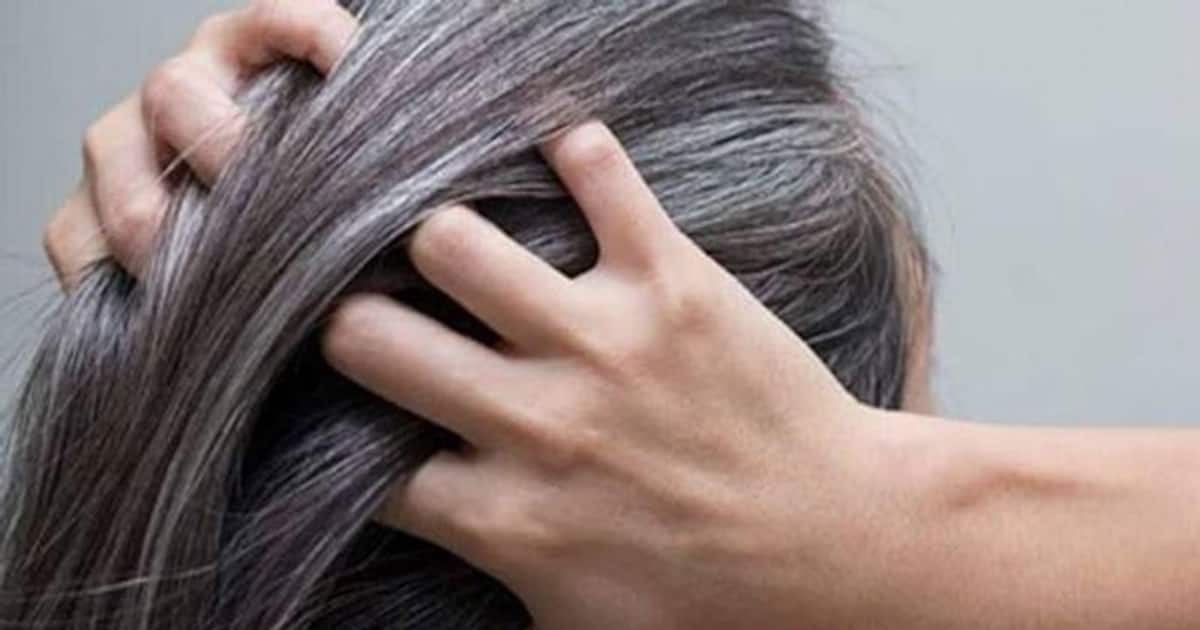 White hair problem: చిన్న వయసులోనే జుట్టు తెల్లగా ఎందుకవుతుంది.. దీన్ని ...