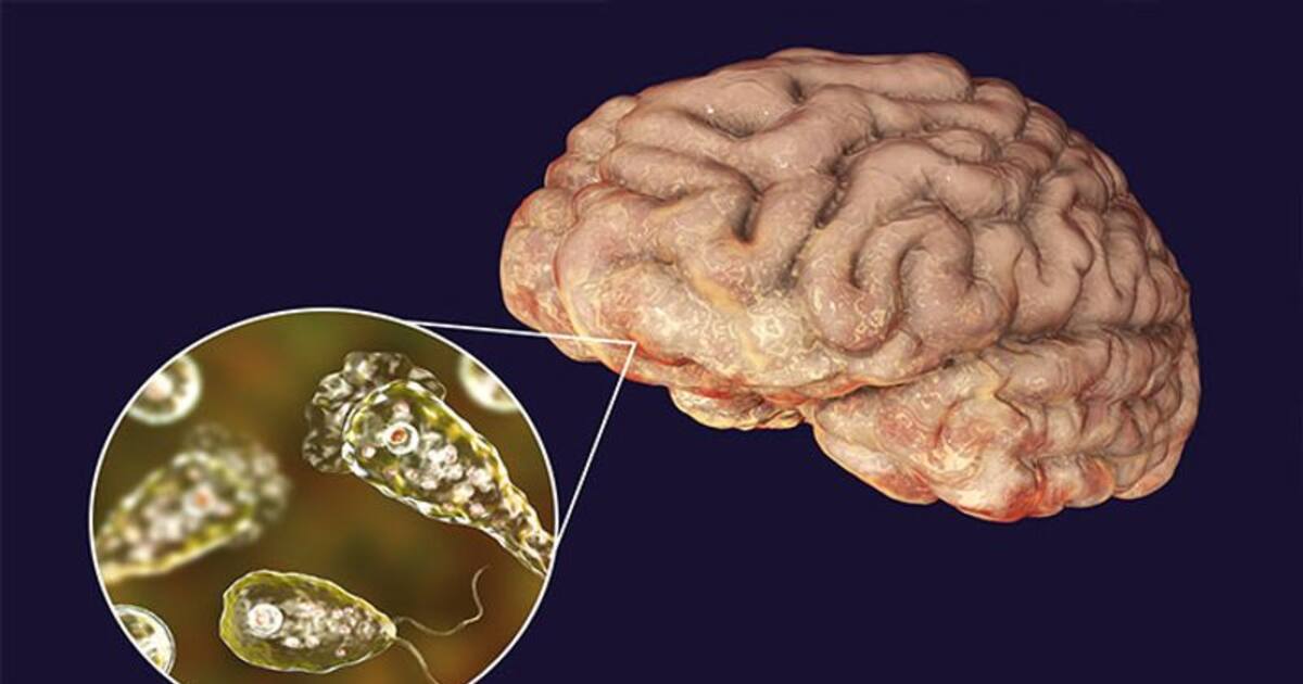 What is Brain-eating amoeba? Know its symptoms, prevention and chances ...
