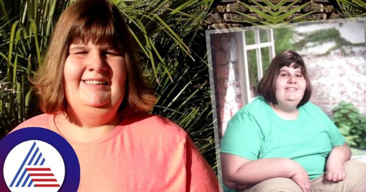 Childhood Obesity: ಐದು ವರ್ಷಕ್ಕೇ ಈಕೆ ತೂಕ 45KG: ಕಾರಣವೇನು ಗೊತ್ತಾ?