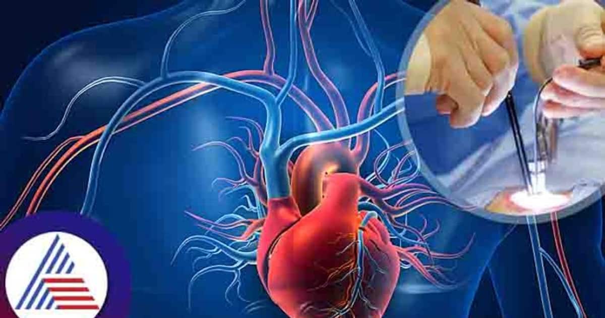 Laser Technology : ರಕ್ತನಾಳ ಬ್ಲಾಕೇಜ್ ತಡೆಯುತ್ತೆ ಲೇಸರ್ ಚಿಕಿತ್ಸೆ