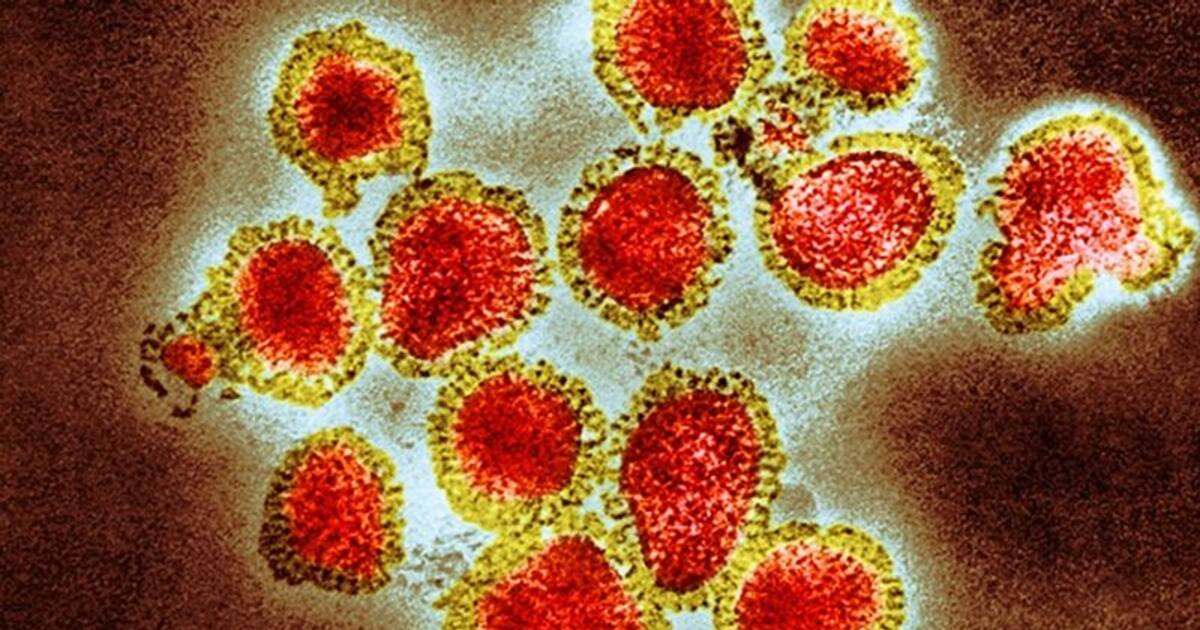 Dangerous pathogen behind Delhi neonatal outbreaks resistant to ...