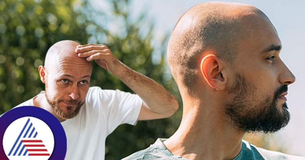 Bald Hair Style ಮಾಡಿದ್ರೆ ಕೂದಲು ದಟ್ಟವಾಗುತ್ತಾ? ಏನಿದ್ರ ಲಾಭ?