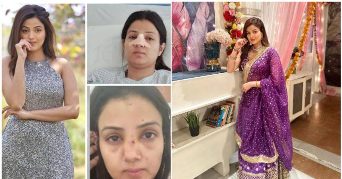 Actress Sumati Singh talks about her emotional distress after nose surgery