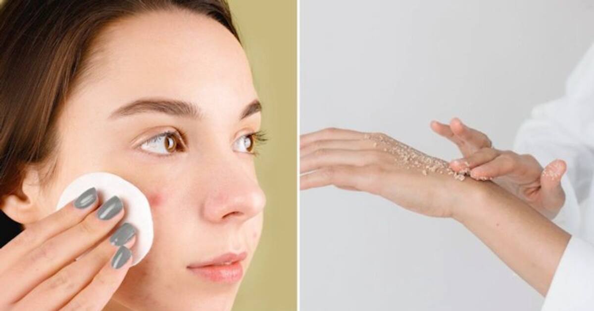 Cleansing to Exfoliating: 7 skin care tips for Oily Skin during Monsoons Cleansing to Exfoliating: 7 skin care tips for Oily Skin during Monsoons