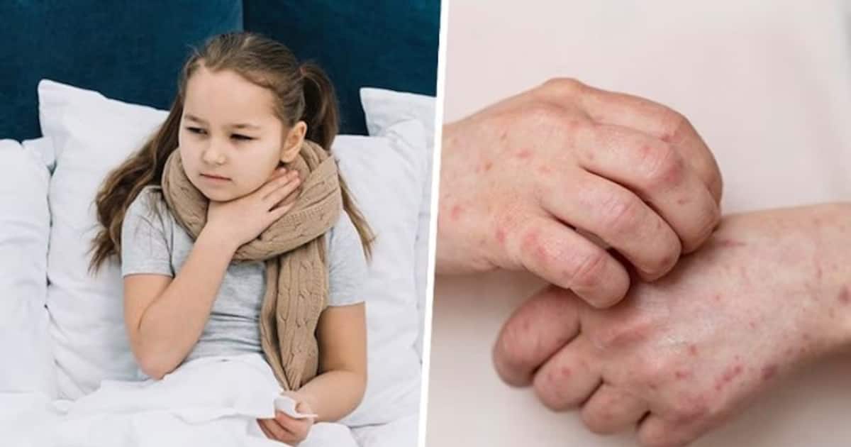 Monsoon Care: 5 types of deadly Fevers that can weaken your Body Immunity