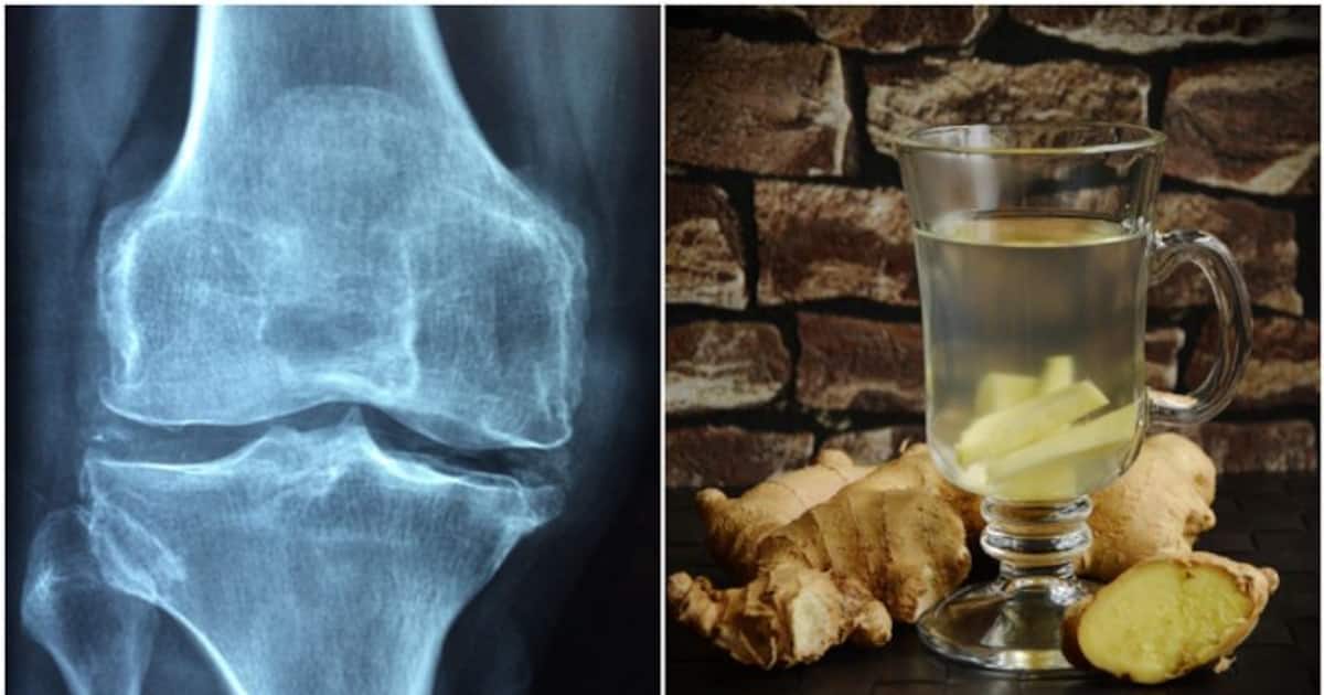 Discover 7 Natural Remedies for Joint Pain: Alleviate discomfort and ...