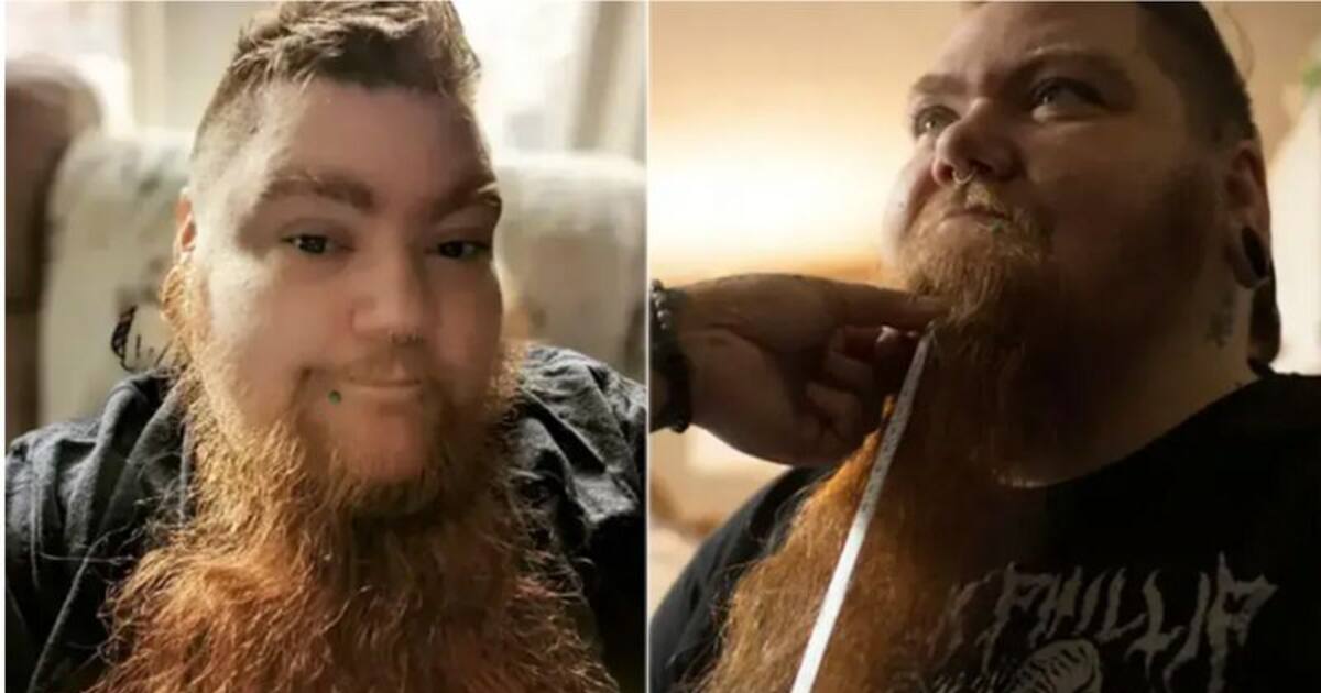 WATCH: US woman with PCOS shatters Guinness World Record for longest ...