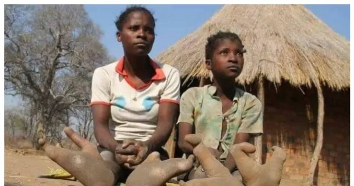 Zimbabwe Vadoma People : ಮುಖ ಮನುಷ್ಯರಂತೆ.. ಕಾಲು ಆಸ್ಟ್ರಿಚ್ ನಂತೆ ...