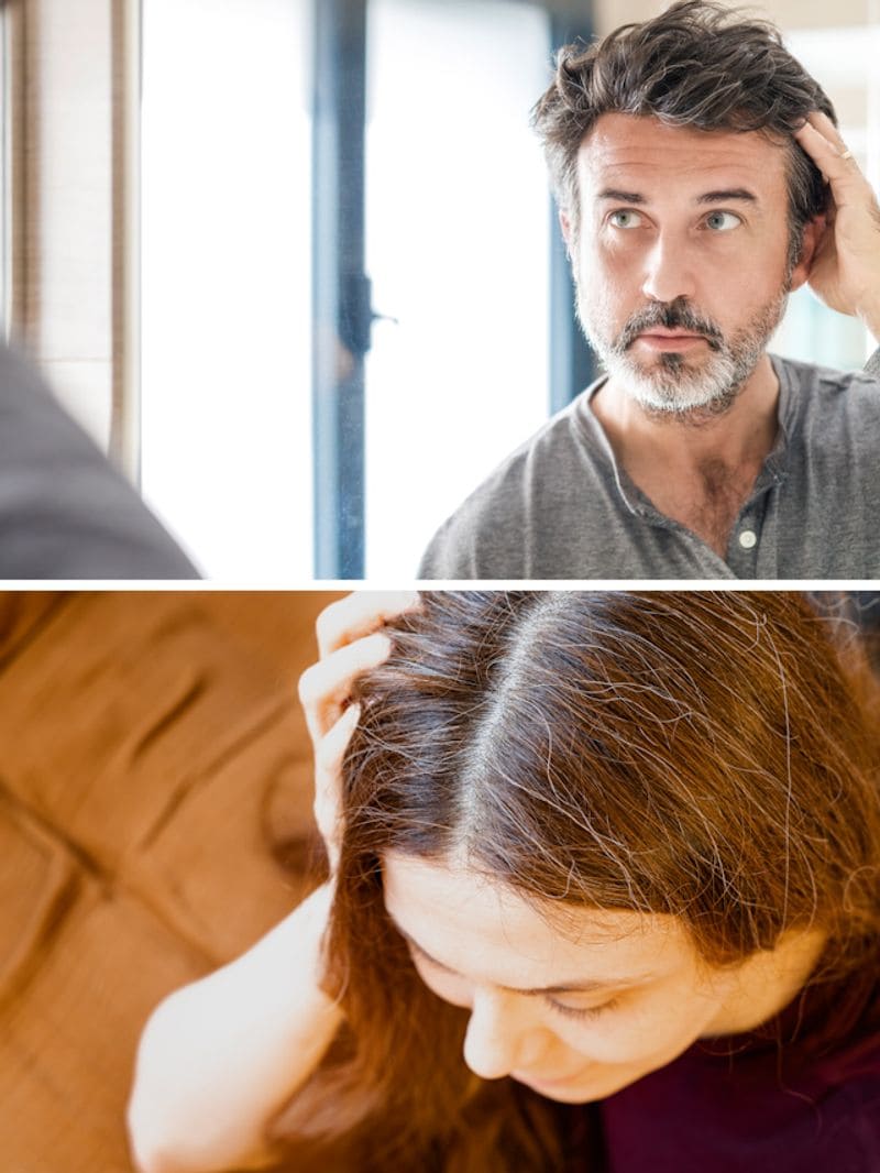 7 things white hair at early age indicate