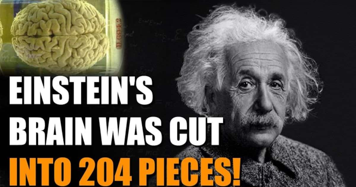 Did you know? Albert Einstein's brain was stolen, cut into 240 pieces! (WATCH)