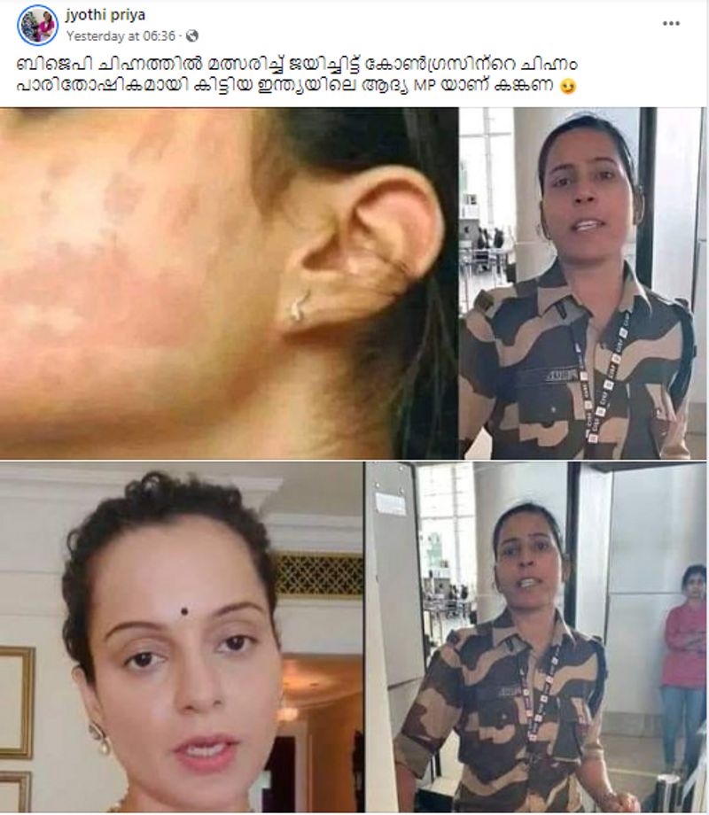 Photo of the slap mark on Kangana Ranaut’s face, Fact Check | സിഐഎസ്എഫ് ...